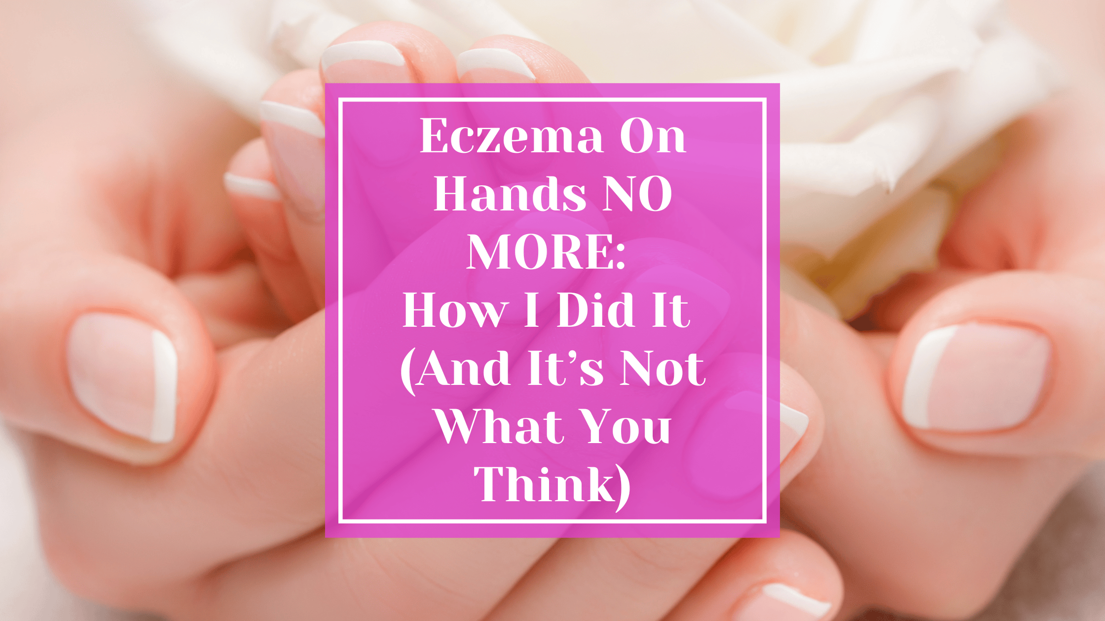 Eczema On Hands: Find: Natural Relief | FarBeyondNutrition
